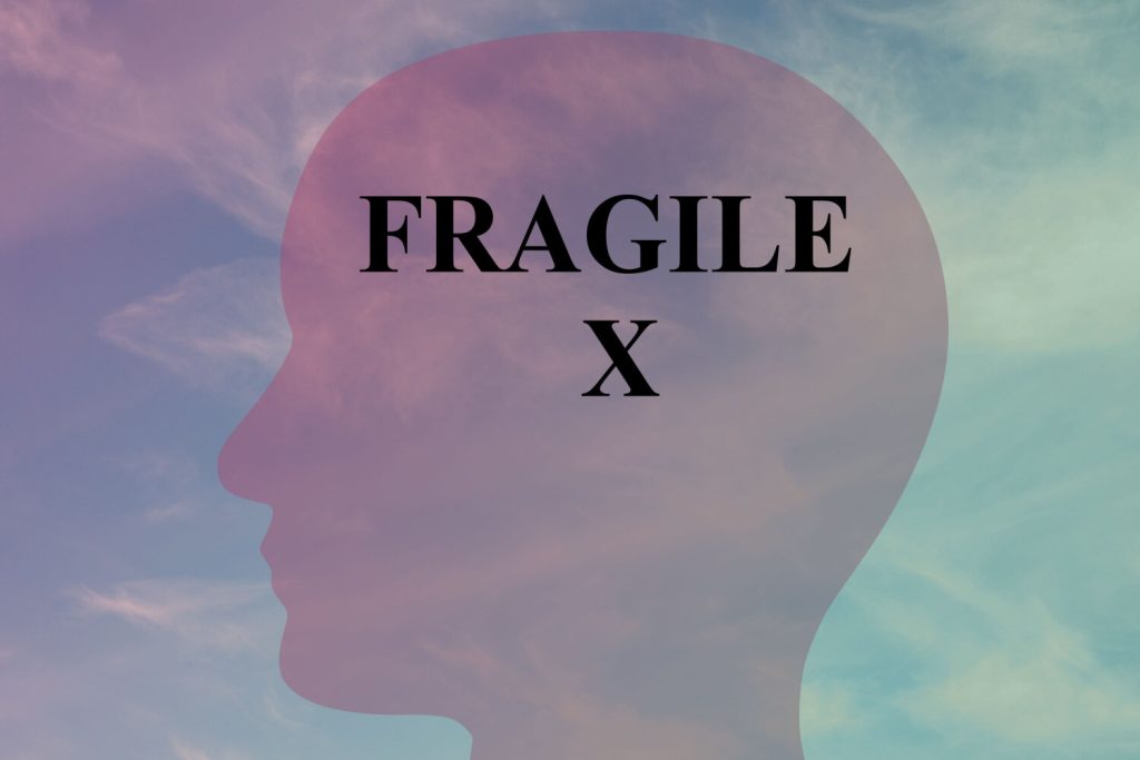 Fragile X Syndrome in Children - Diagnosis and Treatment